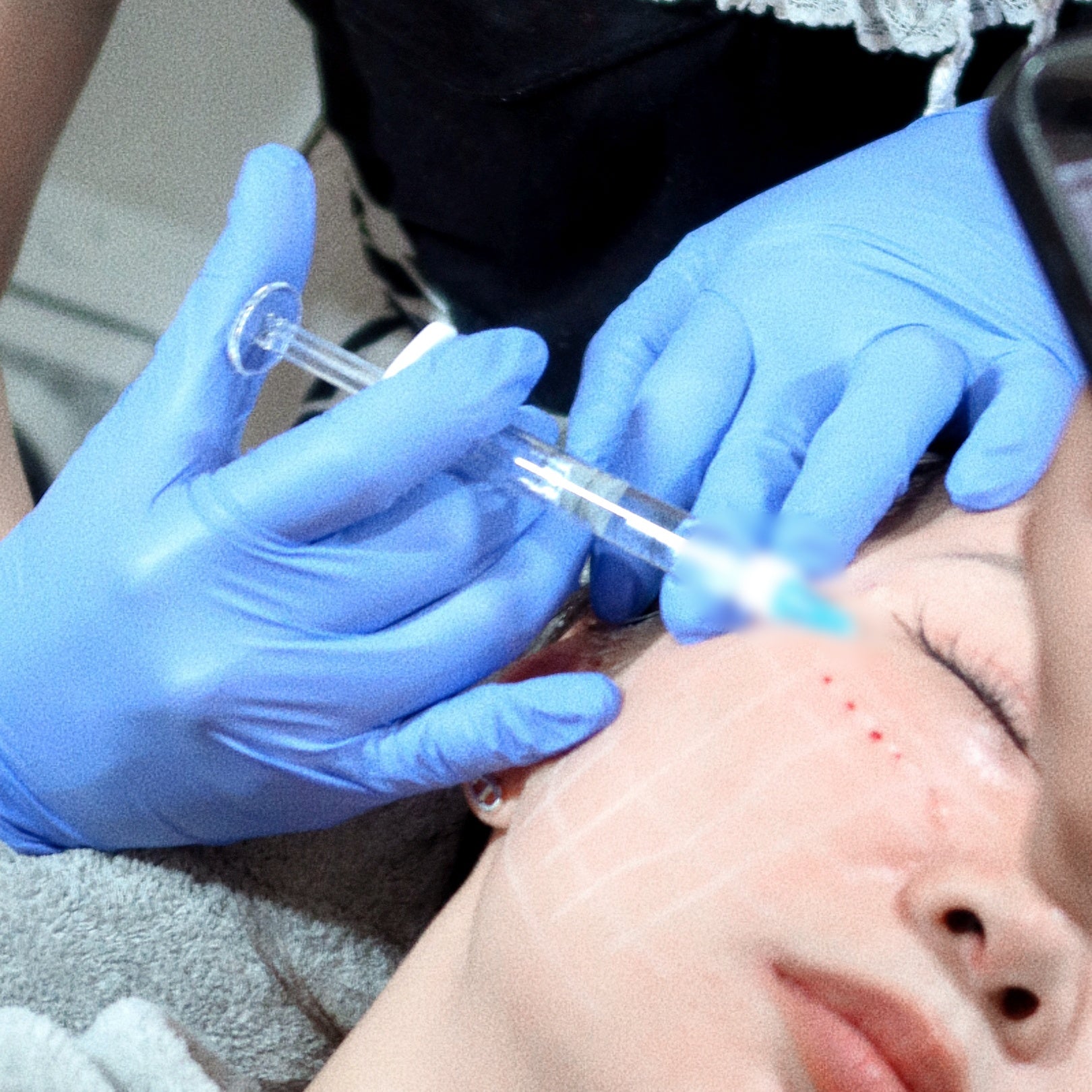 BOOK NOW – MINTSKIN clinic